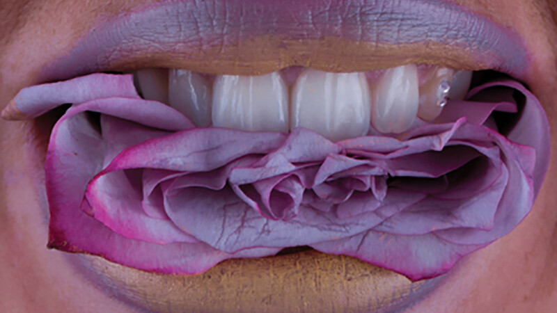 Curiosidades de la boca - Revident Dental Center